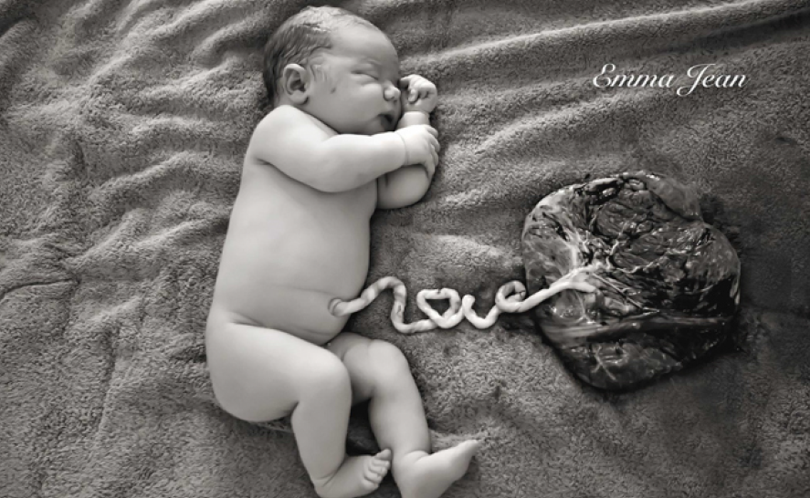 10 Amazing Facts About the Placenta - MekoStem