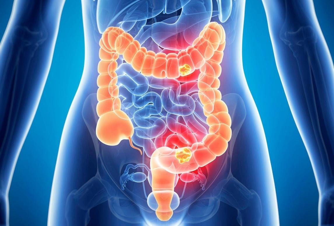 How the intestine replaces and repairs itself - MekoStem